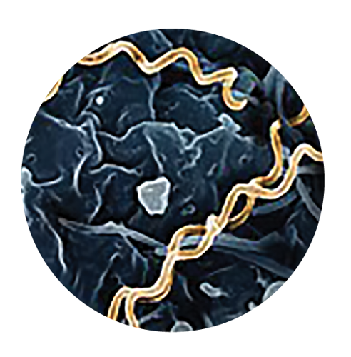 Syphilis surges while gonorrhea declines | Health Wellness ...