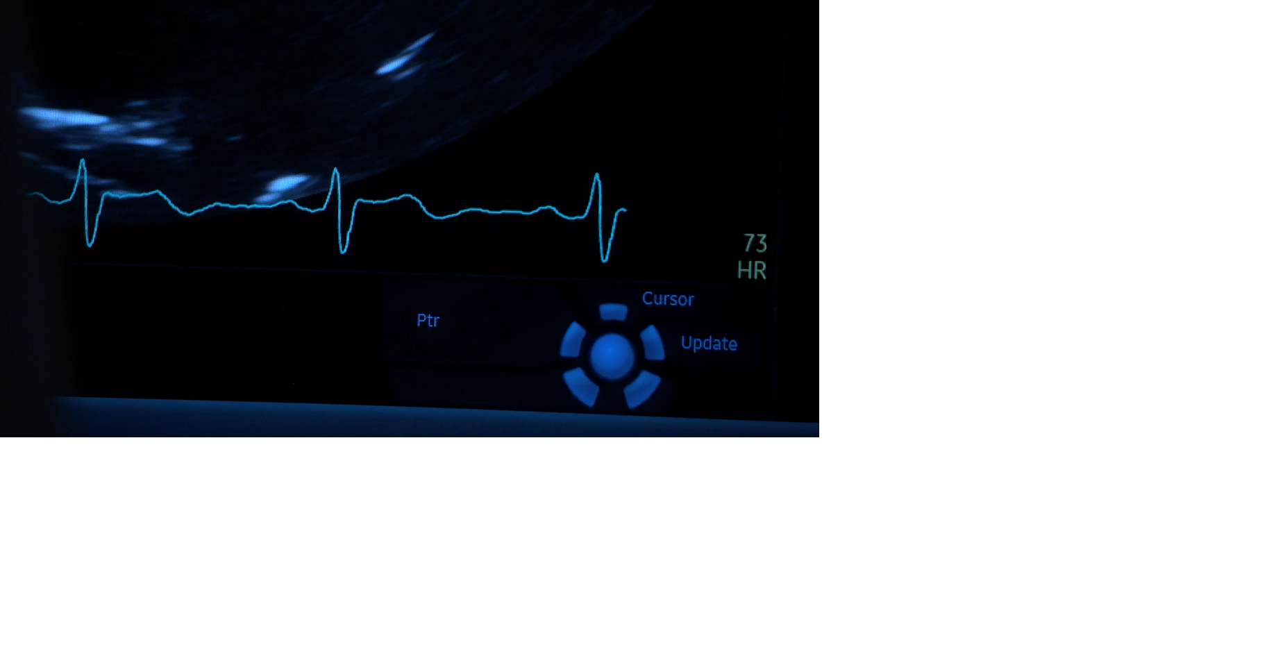 Bozeman Health offers resources for heart health during American Heart ...