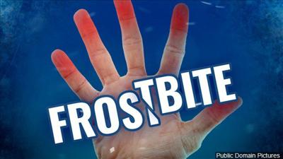 Paramedic warns people of frostbite danger during low temperatures ...