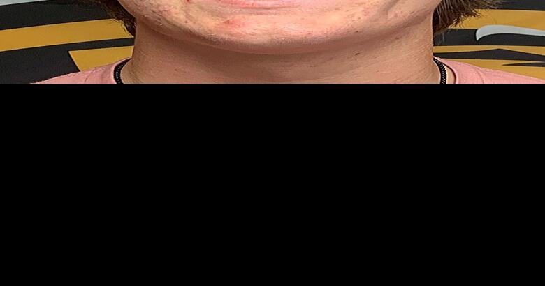 Athlete of the Week (Sept. 20, 2022) -- Hayden Bates, Festus football ...