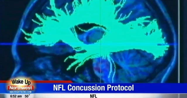 Changes coming to NFL concussion protocol | Top Video | nbcrightnow.com