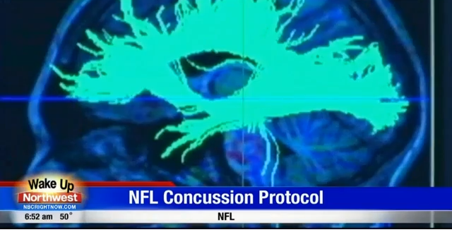 Changes coming to NFL concussion protocol | Top Video | nbcrightnow.com