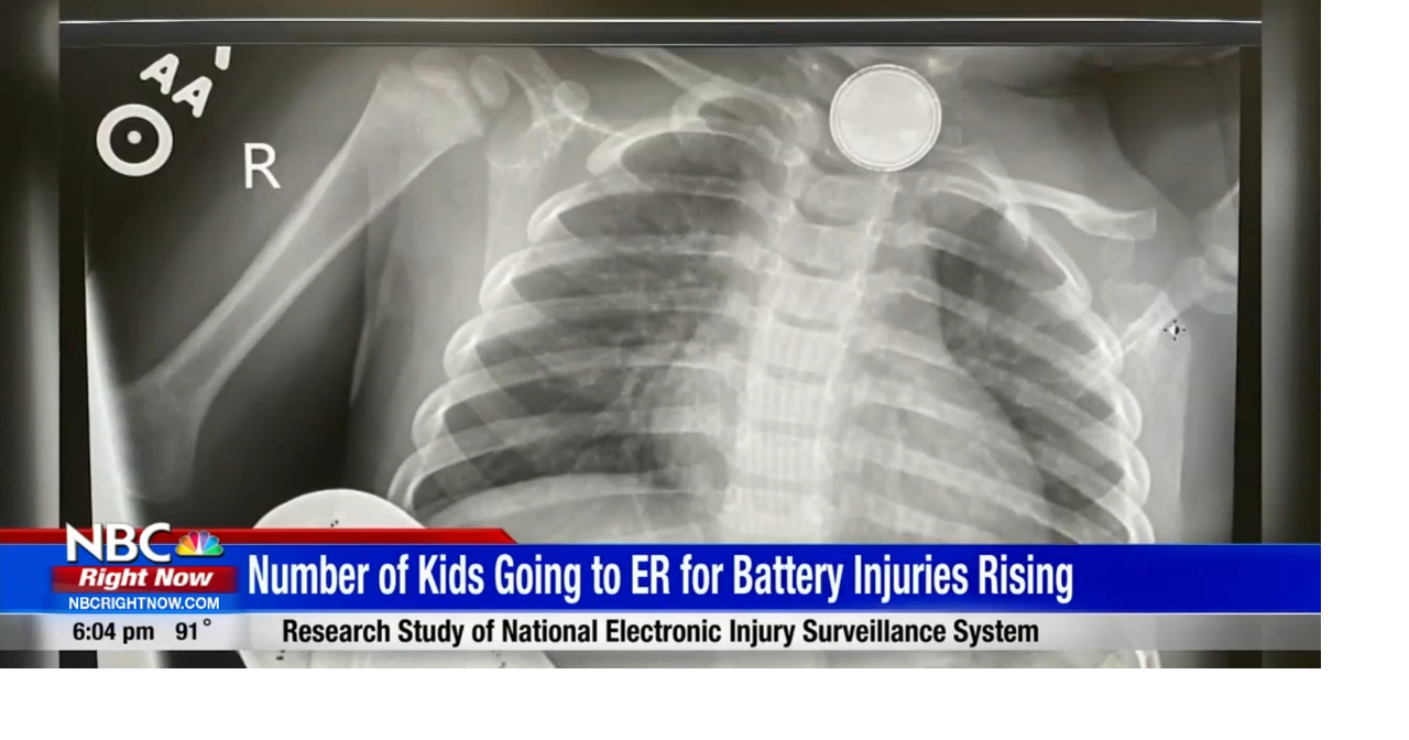 Across the country more kids in the ER after eating button batteries ...