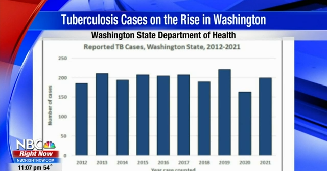 Washington tuberculosis cases on the rise | Straight From The Source ...