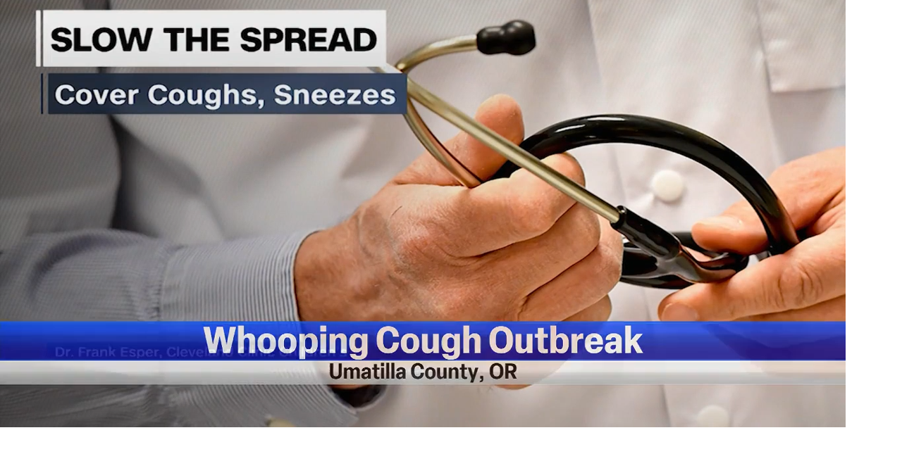 Umatilla County health warns of pertussis spread, 21 cases confirmed ...