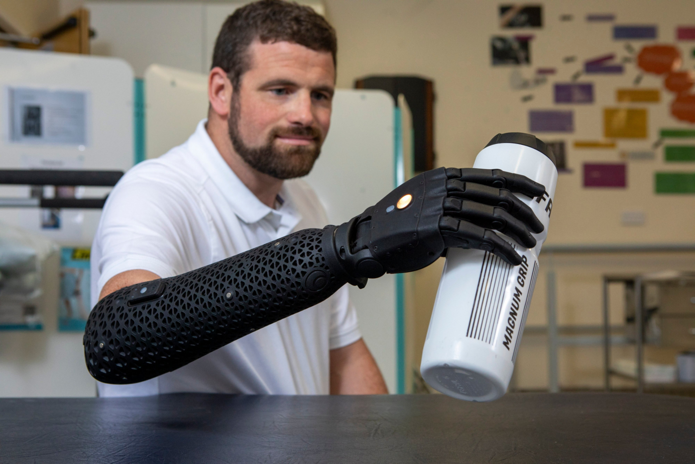 bionic arm nhs