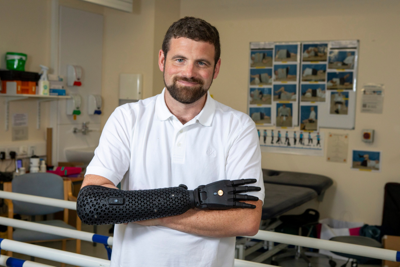 bionic arm nhs