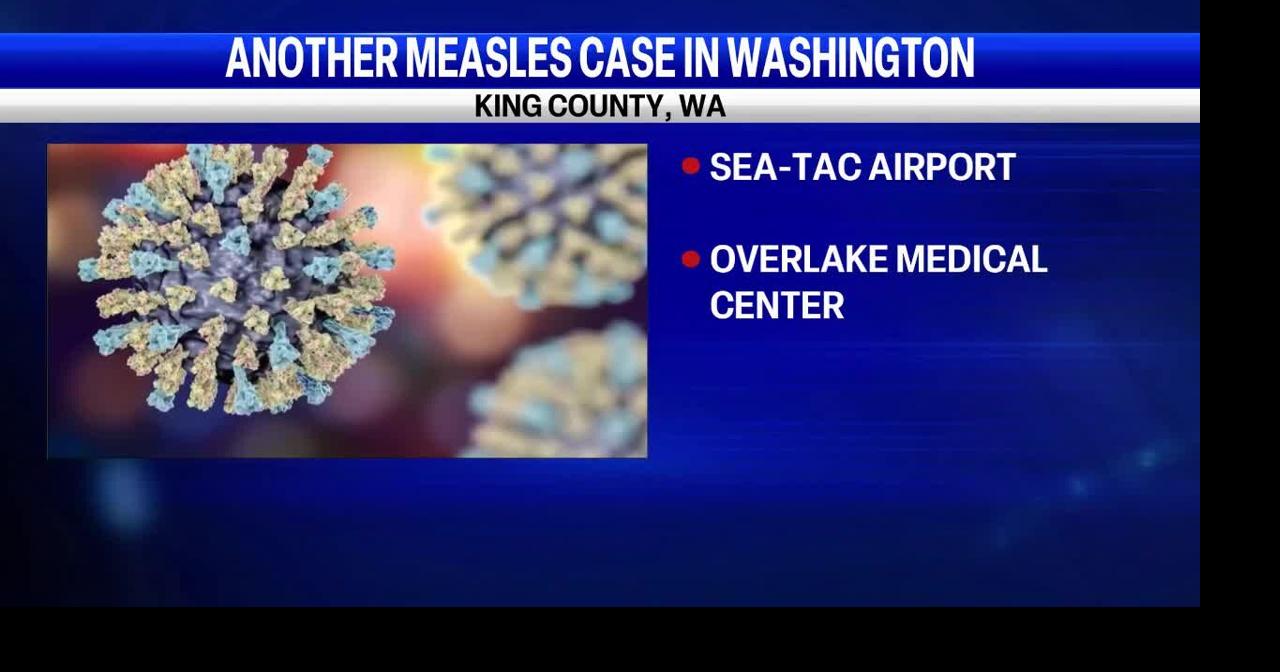 King County confirms sixth measles case in Washington | News ...