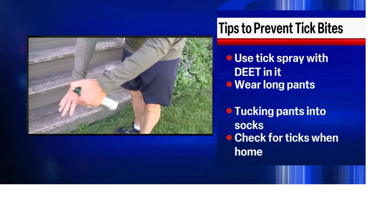A local doctor offers advice on how to avoid tick bites and what to ...