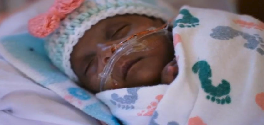 World's smallest surviving baby born in San Diego | News | nbcrightnow.com