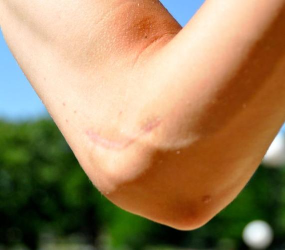 Rantoul's Kyle Flessner on long walk back to the mound after Tommy John ...