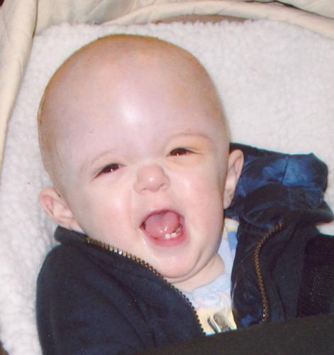 Sunday special: Centennial's Siena perseveres through Muenke Syndrome ...