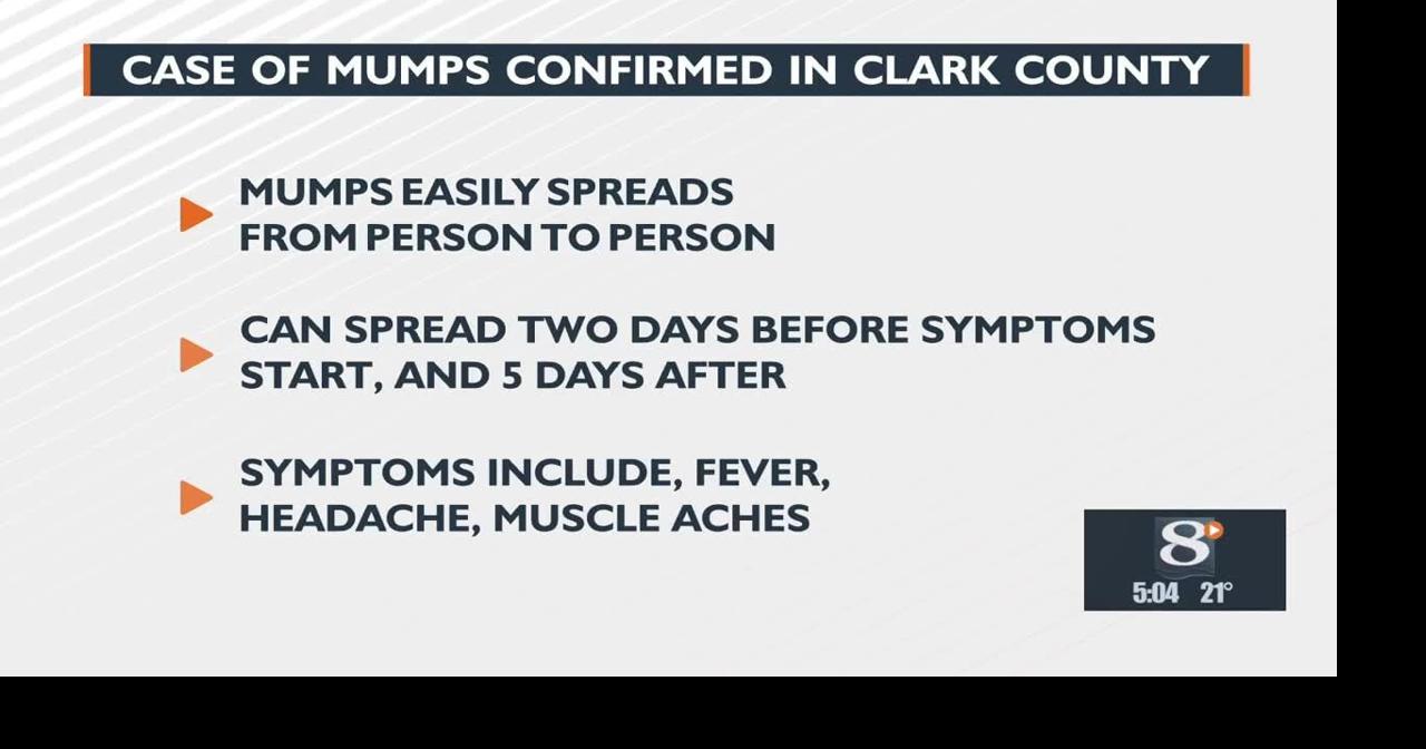 Mumps case confirmed in Clark County | Health | news8000.com
