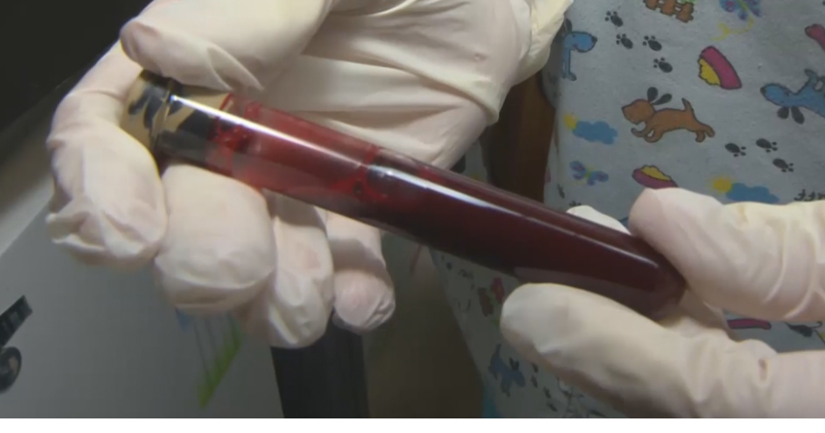 Wis. DHS Recommends Universal Blood Lead Tests for Children | Health ...