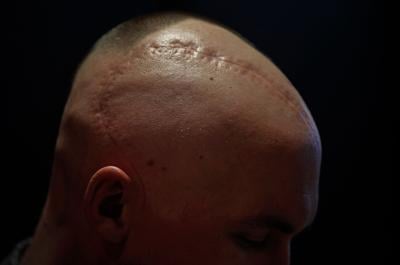 UC med college discovers treatment for brain and blood cancers | News ...