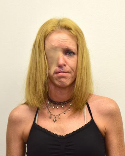 Woman recounts blast to her face | Local News | newstopicnews.com