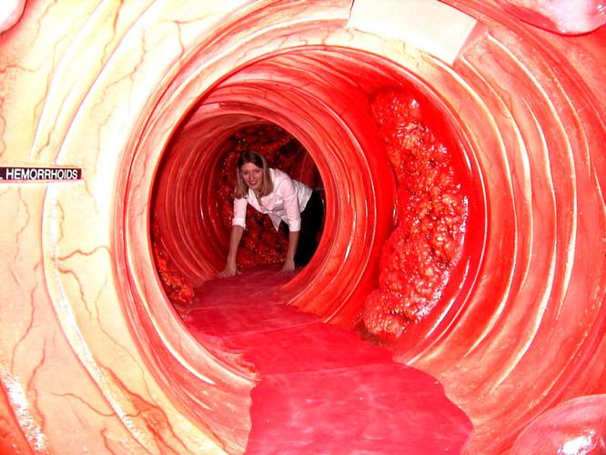 20 years after cancer diagnosis, creator of Colossal Colon pens book ...