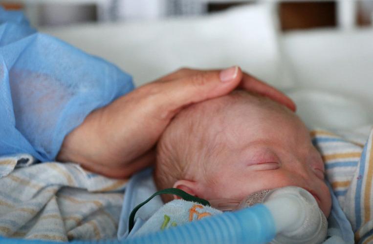 Miracle baby born without a nose in Alabama is 1 in 197,000,000 | News ...