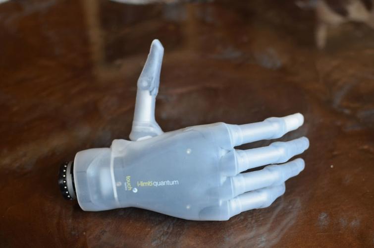 Veteran's bionic hand is turning heads in Mandeville | One Tammany ...