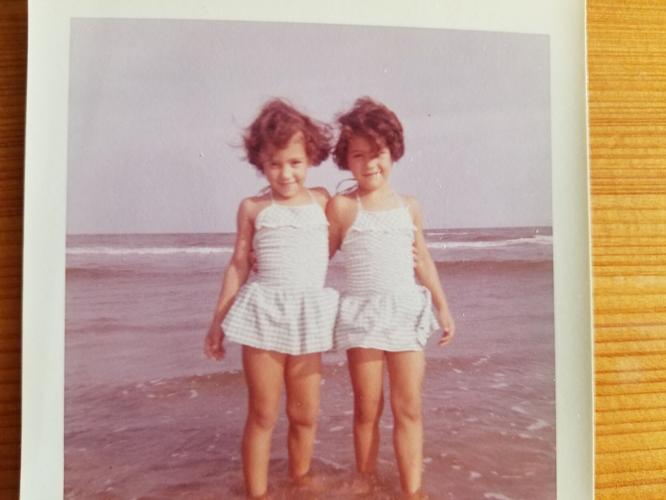 Conjoined Mouton twins from Lafayette, La survived surgery ...