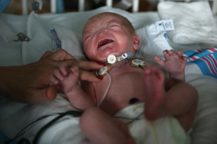 Miracle baby born without a nose in Alabama is 1 in 197,000,000 | News ...