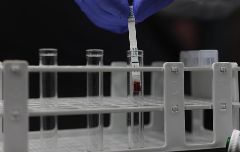 Ebola test developed by Tulane researchers wins 'game-changing' FDA ...