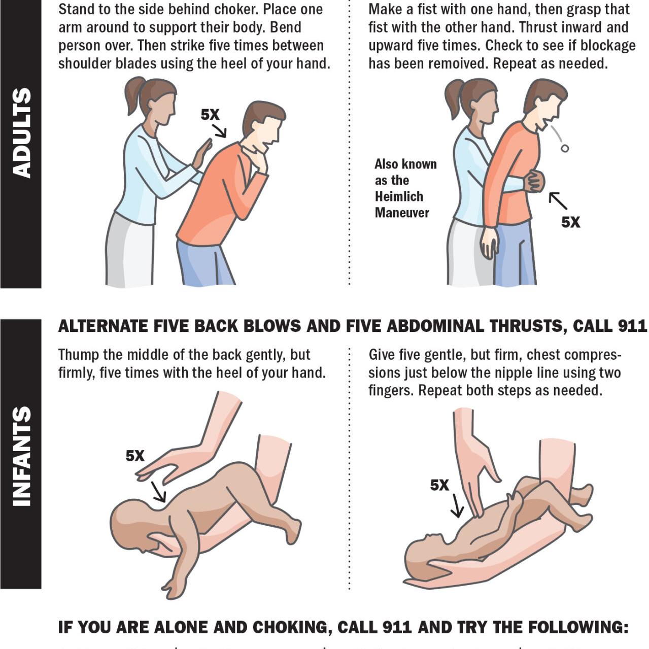 heimlich maneuver