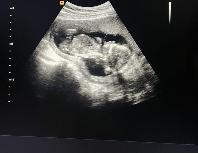 Rainbow baby: Emotional journey of Chanen, Juwan Johnson | Saints ...