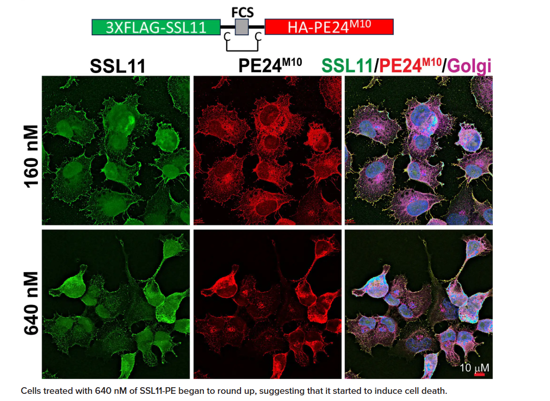 LSU researchers utilizing staph bacteria to fight cancer | Education ...