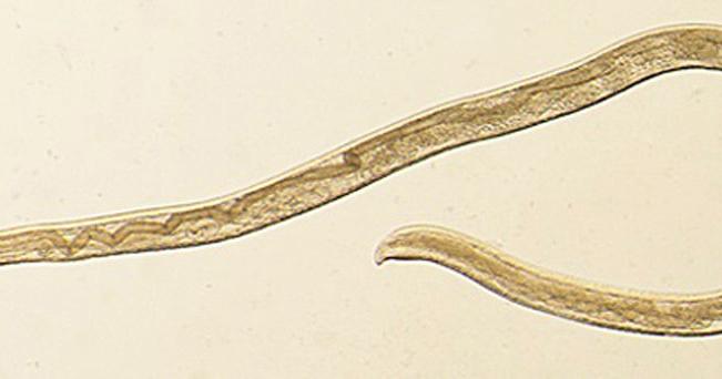 Oregon woman's creepy nightmare: 14 cattle worms found in her left eye ...