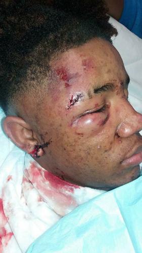 black teens fighting