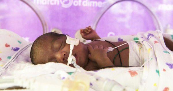 Daphne Robinson: Focus on preterm birth, infant mortality | Opinions ...