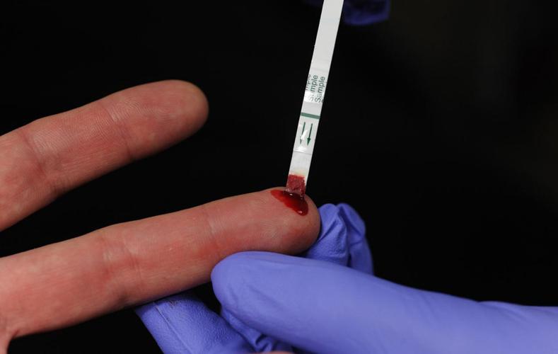 Ebola test developed by Tulane researchers wins 'game-changing' FDA ...