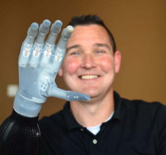 i limb quantum bionic hands