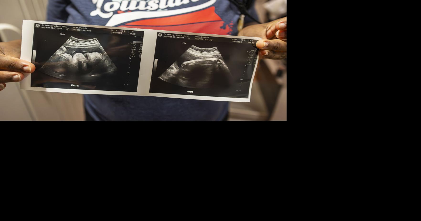 Louisiana receives grant to combat maternal mortality crisis ...