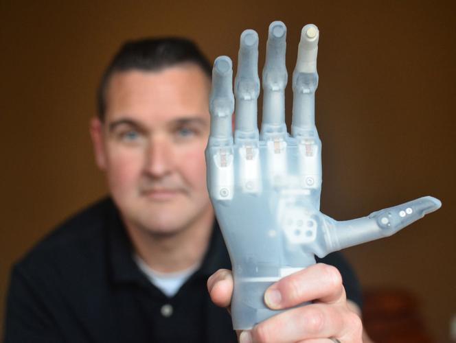 Veteran's bionic hand is turning heads in Mandeville | One Tammany ...