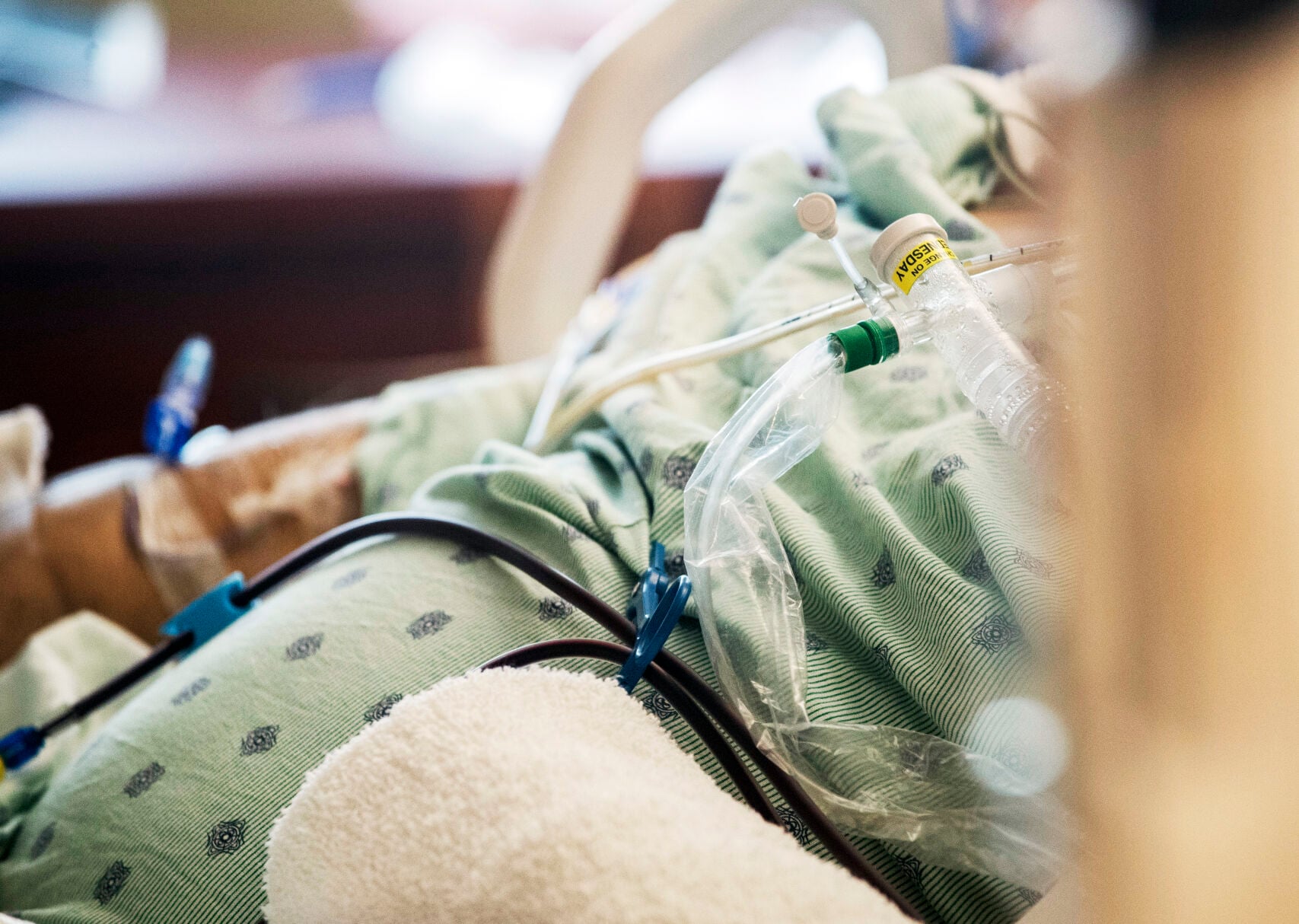 Letters: Bill in Congress would help dialysis patients | Letters | nola.com