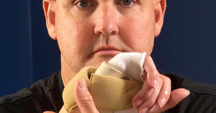 After years of pain, Mandeville man ready for amputation, bionic arm ...