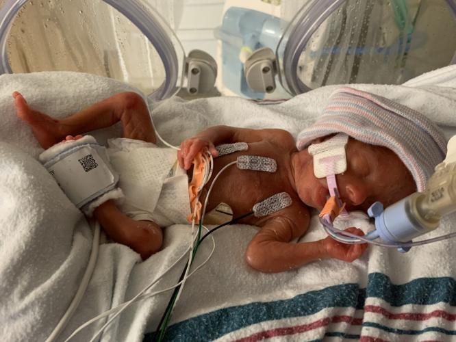 New noninvasive heart surgery saves New Orleans twins | Louisiana ...