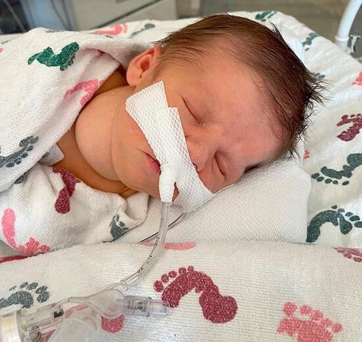 Norfolk family’s baby survives bizarre, rare tumor on neck at birth ...
