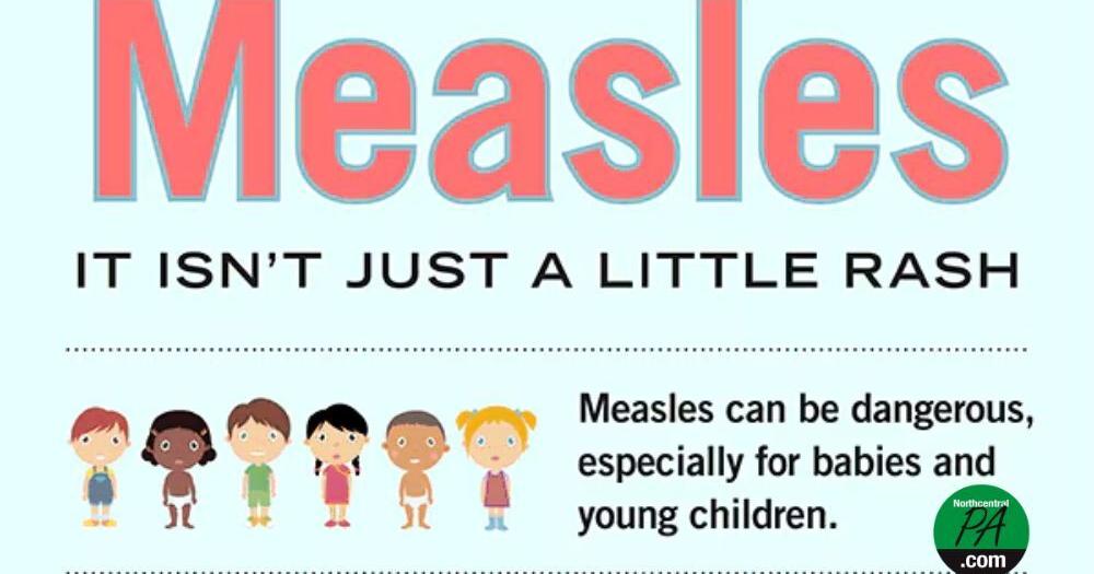 Geisinger pediatric disease specialist: What parents should know about measles | Life ...