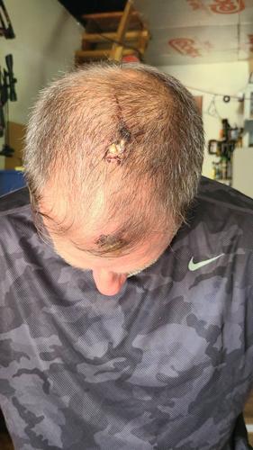 Man survives bear attack | Life | northcentralpa.com