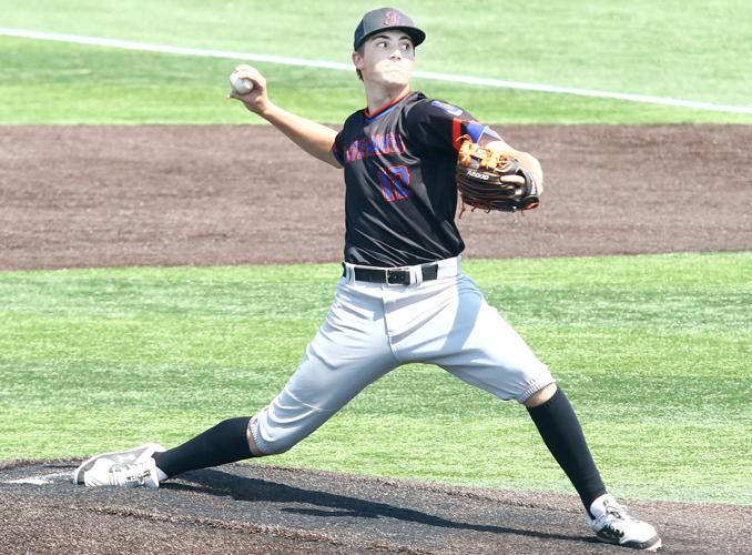 Docs hope depth is the key to a strong Legion baseball season | Legion ...