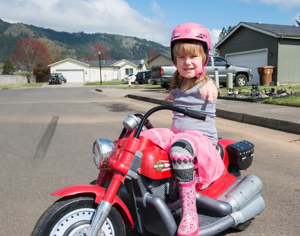 Myrtle Creek girl born without arms gets along just fine | Local News ...
