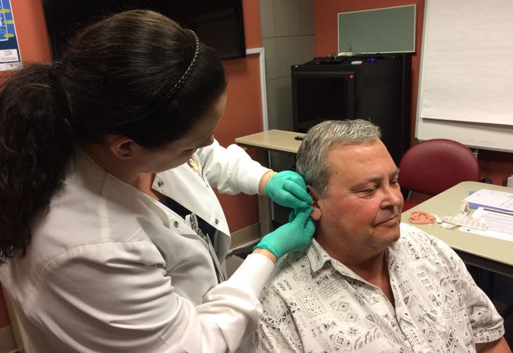 Battlefield acupuncture gives veterans alternative to drugs for pain ...