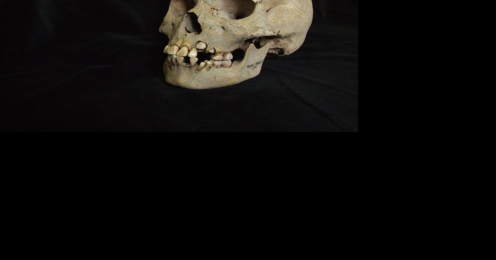 Ancient teeth from Siberia rewrite the plague’s timeline, dating back ...