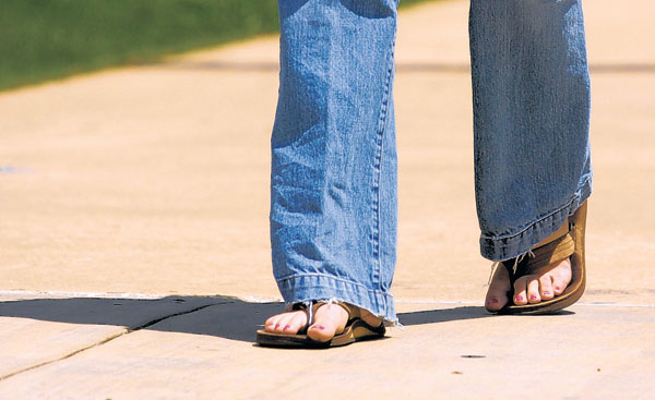 Flip-flops can cause foot problems