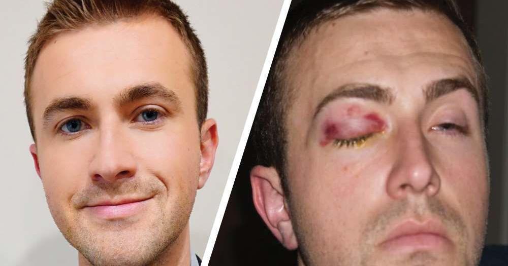 Man hit in the eye by pepper ball during protests in Omaha files claim