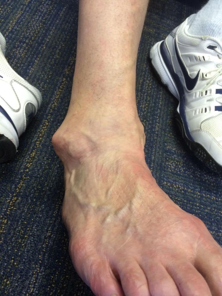 Kearney legend Tom Kropp taught by doing — until his aging body wouldn ...