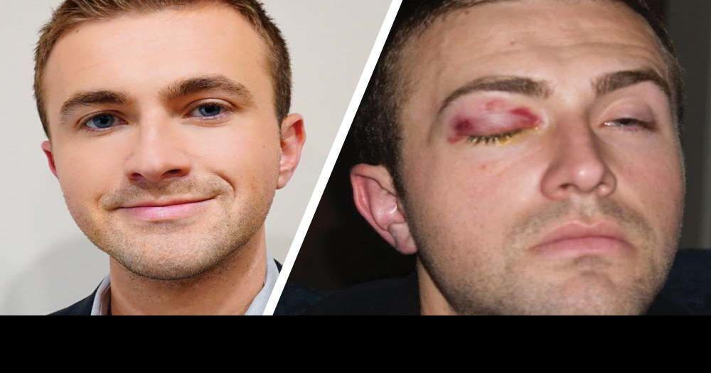 Lawsuit over pepper ball injury during 2020 protest will proceed on two ...